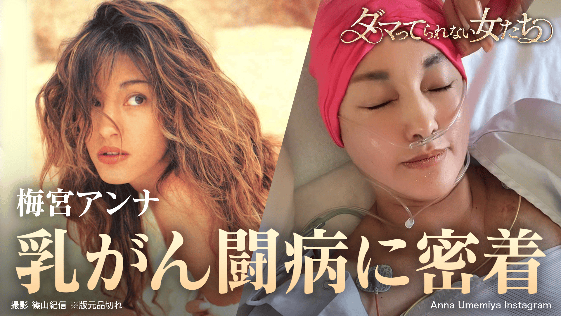 #2: 梅宮アンナ乳がん闘病に密着＆北朝鮮から脱北した女性 - ダマってられない女たち - シーズン1 (バラエティ) | 無料動画・見逃し配信を見るなら | ABEMA