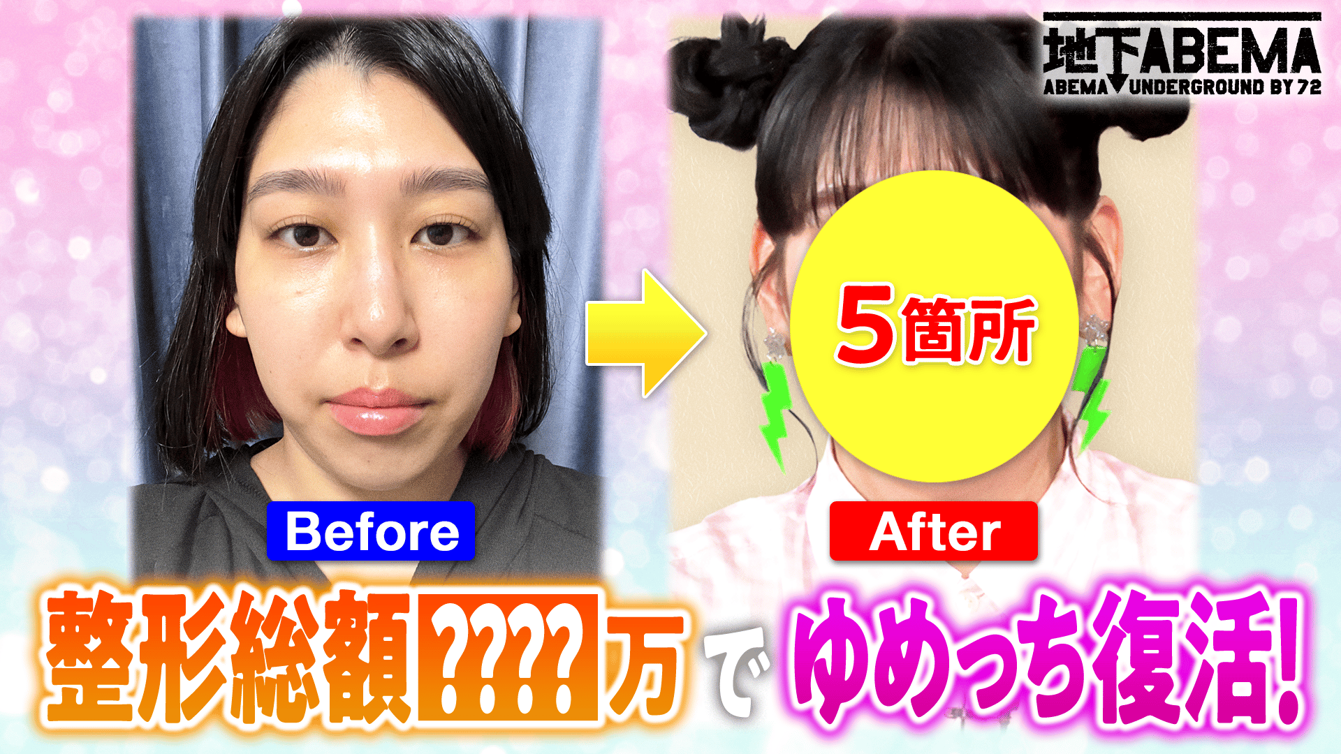 #38：芸能人の整形事情…なんでも答えますSP - ななにー 地下ABEMA - ななにー 地下ABEMA (バラエティ) | 無料動画・見逃し配信を見るなら | ABEMA